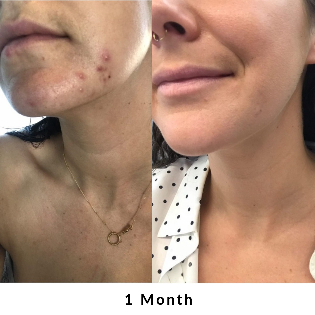 JSHealth Vitamin Skin + Digestion Formula - 60 Tablets – JSHealth ...